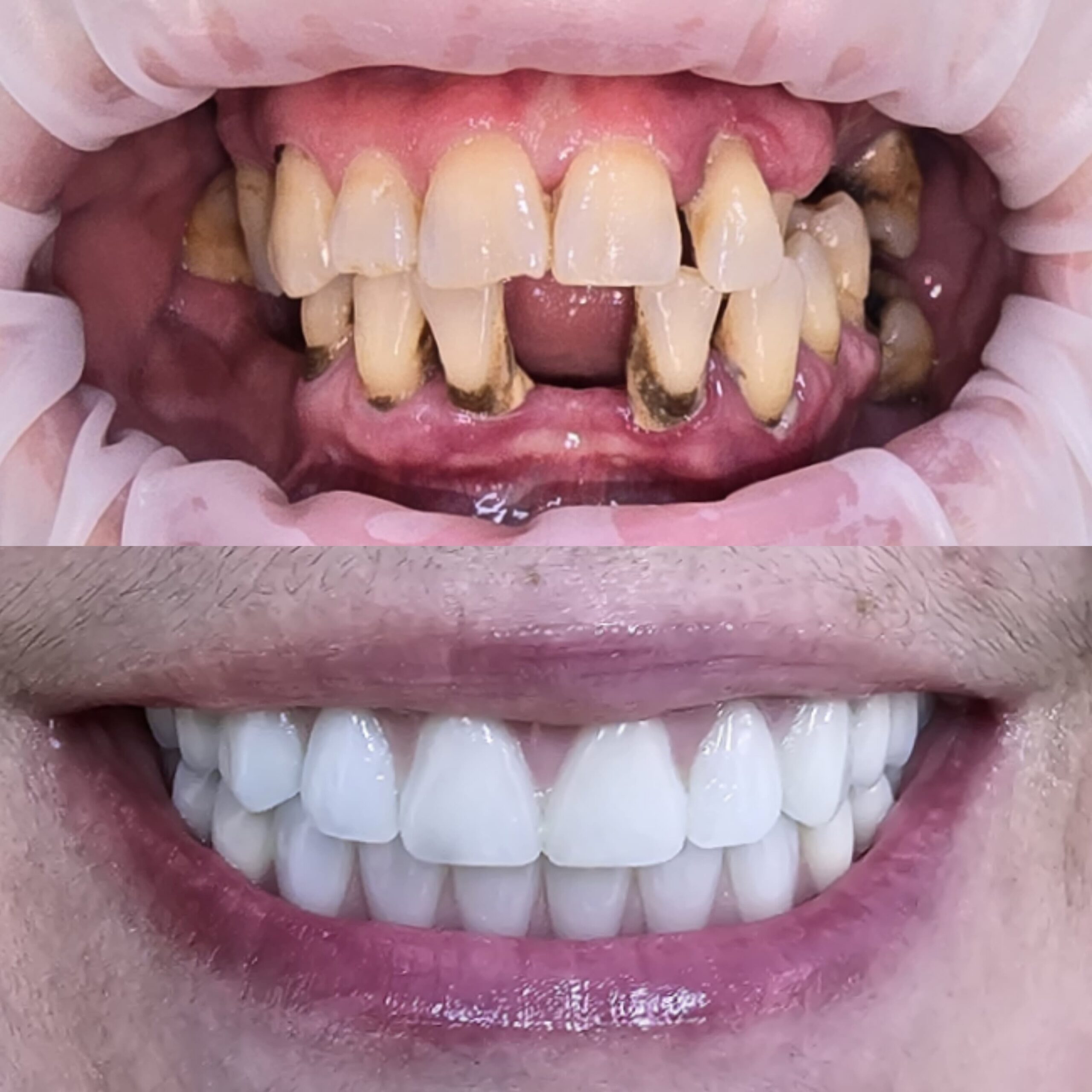 Implant Dentar Fast & Fixed - Dr. Felicia Paduraru